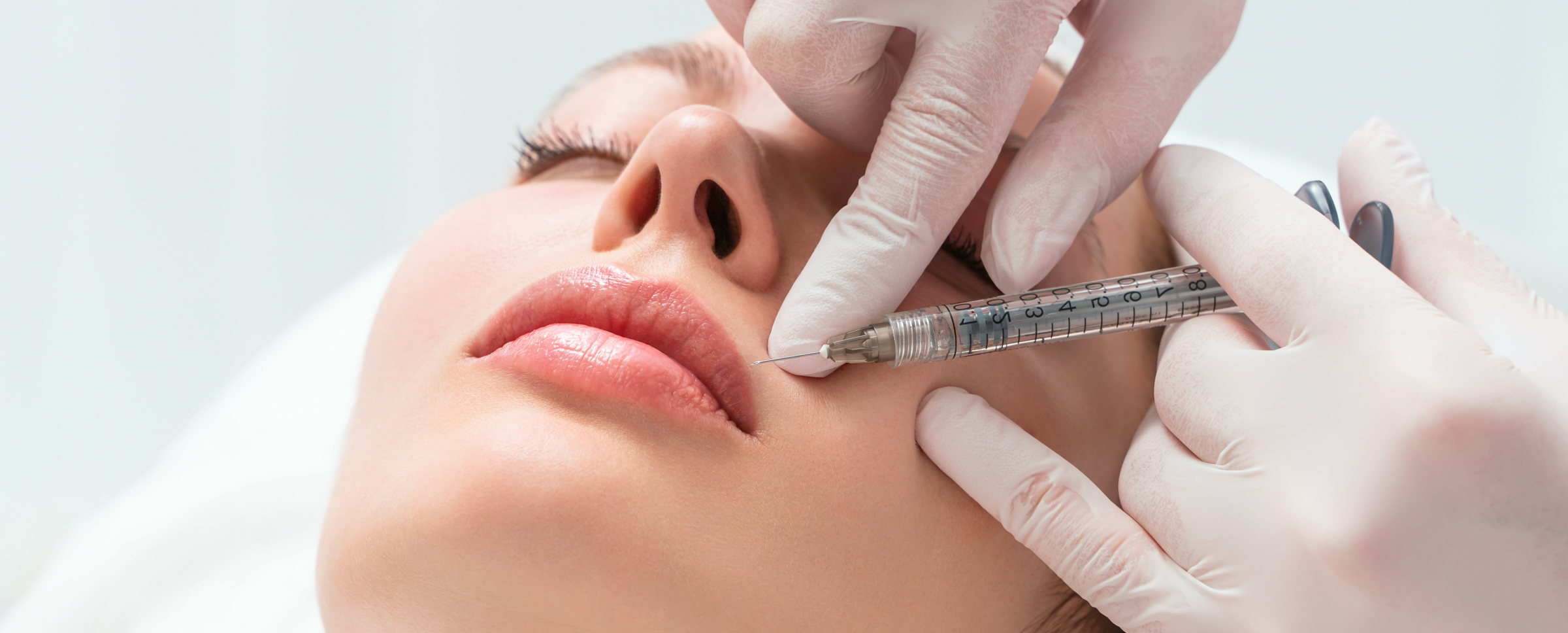Best Lip Fillers In San Diego | Lip Injections in La Jolla